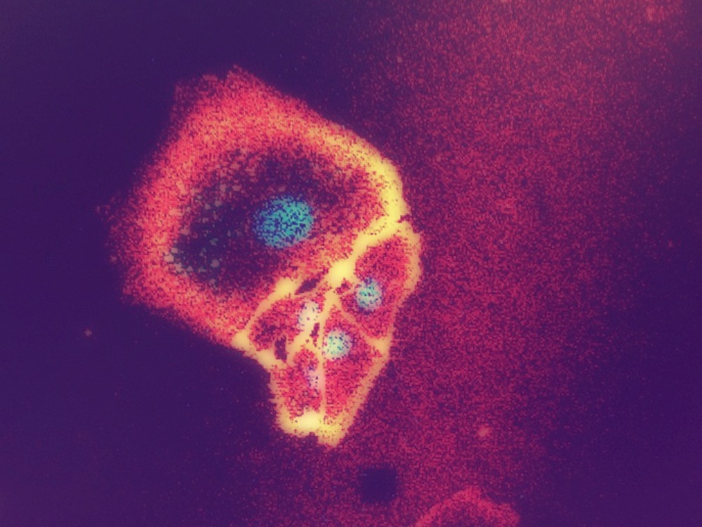 ASCB - Advanced Systemics